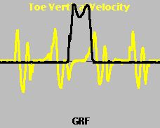 It's clear that the positive (up-going) spikes of vertical ...